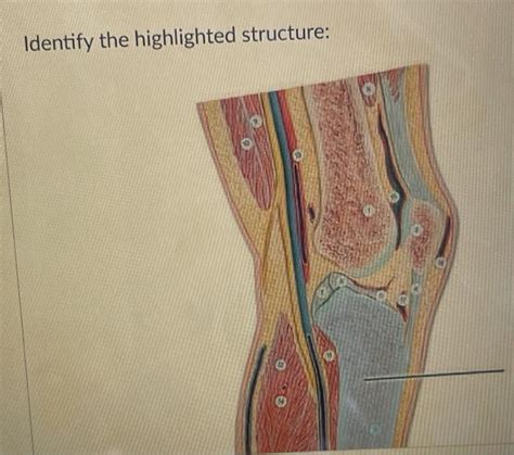 solved identify the highlighted bone identify the