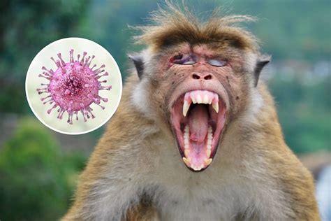 Monkey Bite Gives Man Rare Virus Focusing On Wildlife