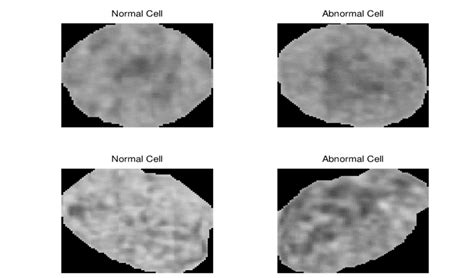 Examples Of Segmented Normal And Abnormal Cervical Cell Nuclei Download Scientific Diagram