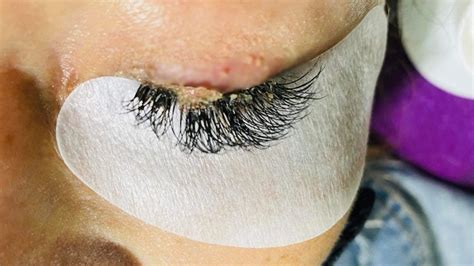 อุทาหรณ์ สาวโร่ถอดขนตาปลอม หลังช่างใช้กาวไม่ได้มาตรฐาน ติดขนตาจนเป็นก้อน