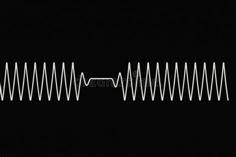White Waveform Oscillating Regularly Is Interrupted And Shows Loss Of Signal Creating A Flat