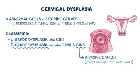 Cervical Cancer Cell Stages Types Of Cervical Cancer Stages Of