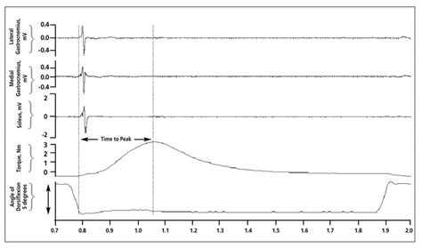 Sample Electromyogram Emg Traces Of Torque And Reflex Action Download Scientific Diagram