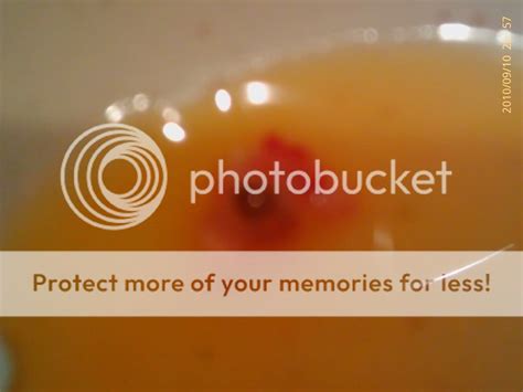 Quail Embryo Development Graphic Pg 13 Backyard Chickens Learn How To Raise Chickens