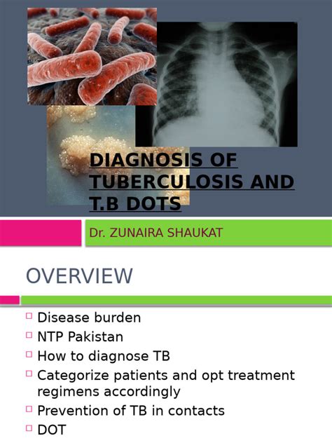 Diagnosis Of Tuberculosis Ppt Pdf