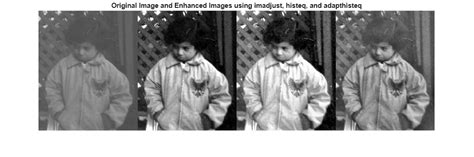 Contrast Adjustment Matlab And Simulink
