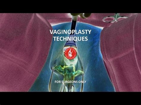 Vaginoplasty Vaginal Rejuvenation Surgery With Manual Robotic Arms Youtube