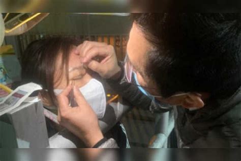 女子割完双眼皮后小区被封 医生自带工具隔栅栏为其拆线 双眼皮 自带 医生