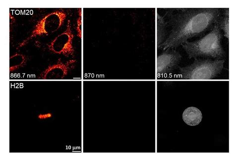 Immuno Staining And Srs Imaging Of Tom20 Mitochondrial Marker And