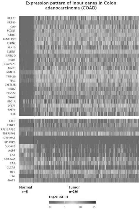 Method For Detecting Expression Quantity Of Tumor Related Gene Spectrum
