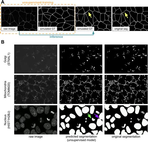 MMV Im Im An Open Source Microscopy Machine Vision Toolbox For Image To Image Transformation