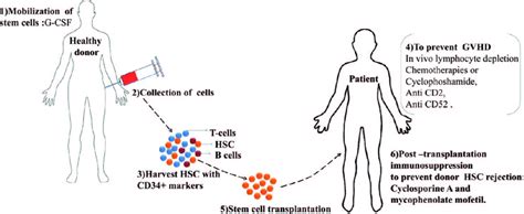 Allogeneic Stem Cell Transplantation Download Scientific Diagram