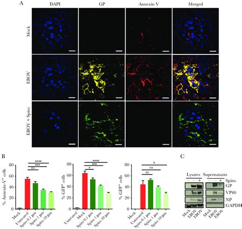 Blocking Vesicle Trafficking To The Plasma Membrane Reduces Ebola Virus Download Scientific
