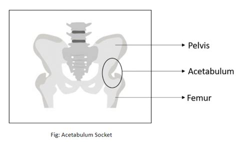 The Acetabulum Is A Socket For Which Bone