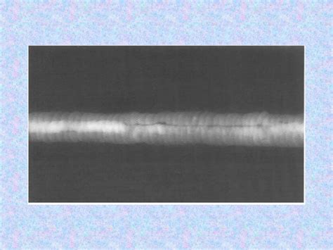Types Of Radio Graphic Rt Weld Examination Defects Ppt Medical Tests Medical Health