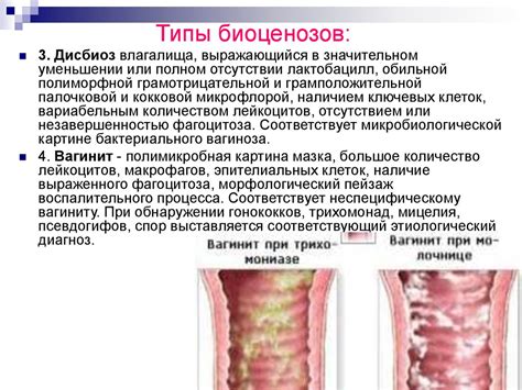 Фемофлор-скрининг. Биоценоз влагалища - online presentation