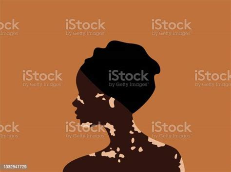 주황색 배경에 Vitiligo와 터번에서 아프리카 여성의 측면 보기 바디 포지티브 컨셉 플랫 벡터 일러스트레이션 백반증에 대한 스톡 벡터 아트 및 기타 이미지 Istock