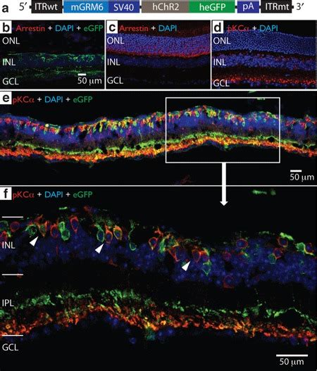 Chr2 Hegfp Is Selectively Targeted And Expressed In On Bipolar Cells In Download Scientific
