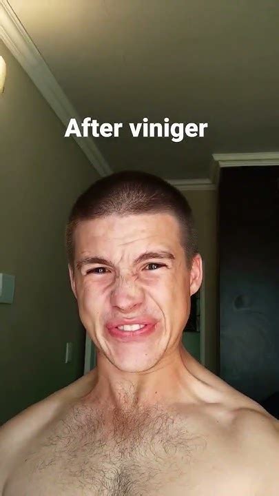 Before Viniger Youtube