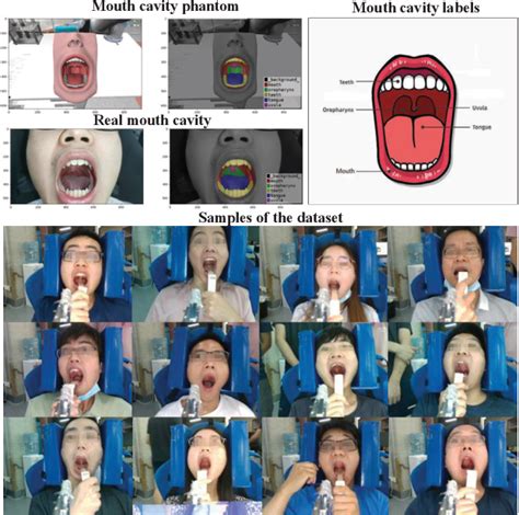 Figure 1 From A Lightweight Deep Learning Network For Mouth Cavity