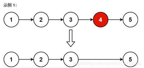 删除链表的倒数第n个结点 力扣（中等）删除链表的倒数第n个节点力扣 Csdn博客