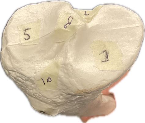 Inferior View Of Tibia Diagram Quizlet