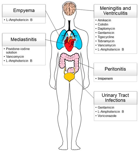 Alternative Antimicrobial Irrigation Strategies For The Treatment Of