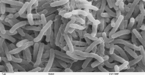 Théorie Microbienne Encyclopédie De Lhistoire Du Monde