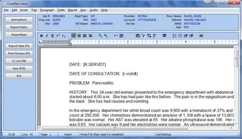 ChartNet Editor Keyboard Shortcuts DefKey
