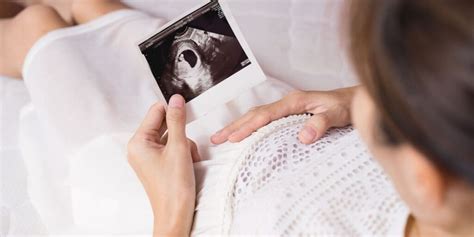 Apa Itu Anencephaly Ini Gejala Dan Penyebabnya Pada Janin Yoona