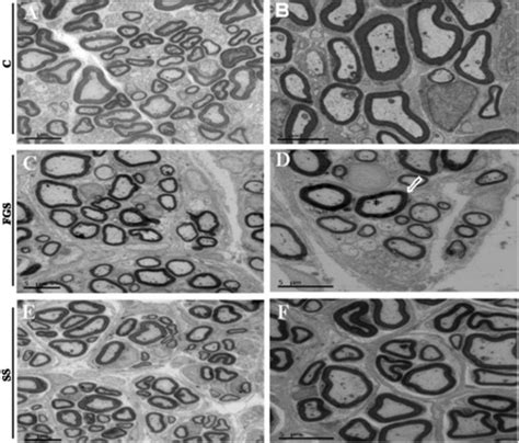 Ultrastructural Analysis Of The Sciatic Nerve Sciatic Nerve Ultrathin