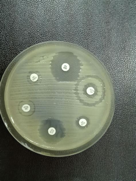 I Have Question About Diagnosis Of A Antibiogram Pattern Of A Bacteria Researchgate