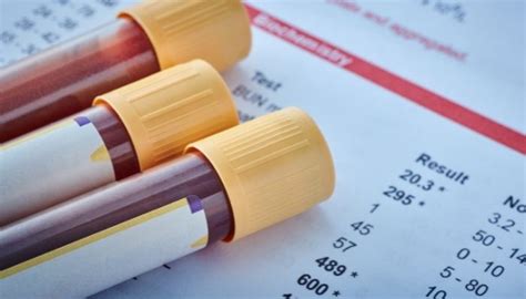 Flow Cytometry Test An Overview On Flow Cytometry Blood Test Livlong