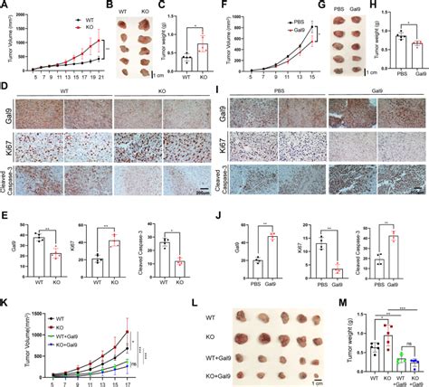 Atxn3 Functions As A Tumor Suppressor Through Potentiating Galectin 9 Mediated Apoptosis In