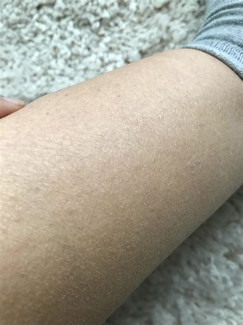 Why Is The Skin On My Legs Always Scaly And Dry Skin Concern Routine Help Rskincareaddiction