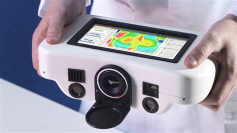 Saving Lives Through Early Foot Ulcer Detection Npl