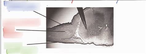 Lab Practical Spinal Part Diagram Quizlet