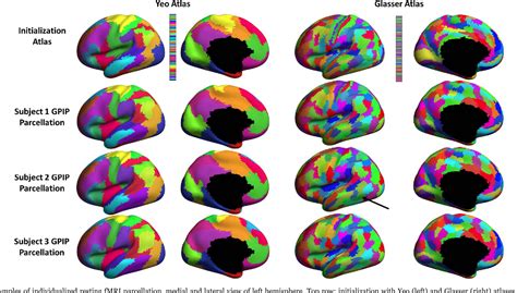 Figure 2 From Individual Parcellation Of Resting Fmri With A Group Functional Connectivity Prior