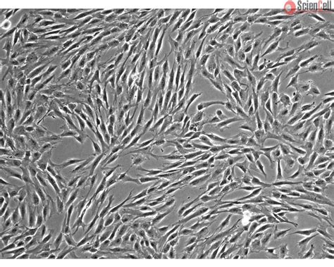 Human Bone Marrow Cells