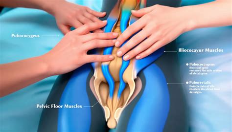 Hypertonic Pelvic Floor Symptoms And Solutions 2024