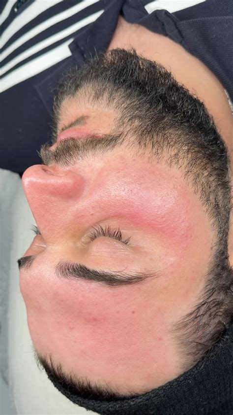 Alan Skincare ‎جوانی جوانکاری پێست جوانیپێست‎ Instagram