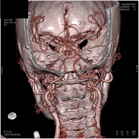 Where Is The Quick Analysis Button Nessdas