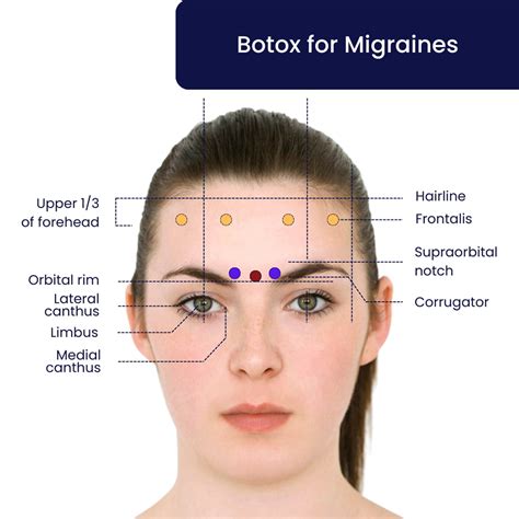 Botox For Migraines In Brooklyn Nyc And Nj