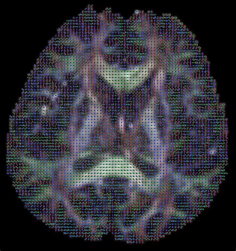 Mri Image Analysis On A Raspberry Pi Piday Raspberrypi Raspberrypi Adafruit Industries