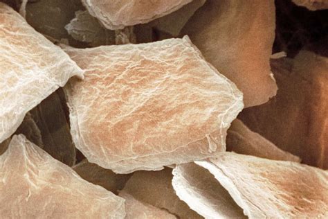 34 Facts About Dermis