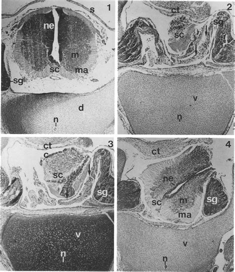Cross Section Through The Thoracic Vertebrae And The Spinal Cord Of An