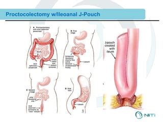 Combined 12 Clinical Training Surgical Procedures Ppt