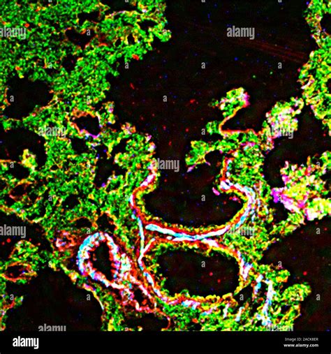 Lung Tissue Fluorescence Deconvolution Micrograph Of A Section Through Lung Tissue This Tissue