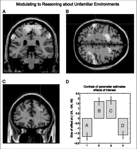 An Spm Rendered Into Standard Stereotactic Space And Superimposed On To Download Scientific