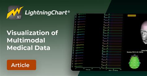 3d Medical Imaging Visualization Of Multimodal Medical Data